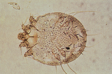 Vid klåda, tänk alltid på skabb! – Läkartidningen
